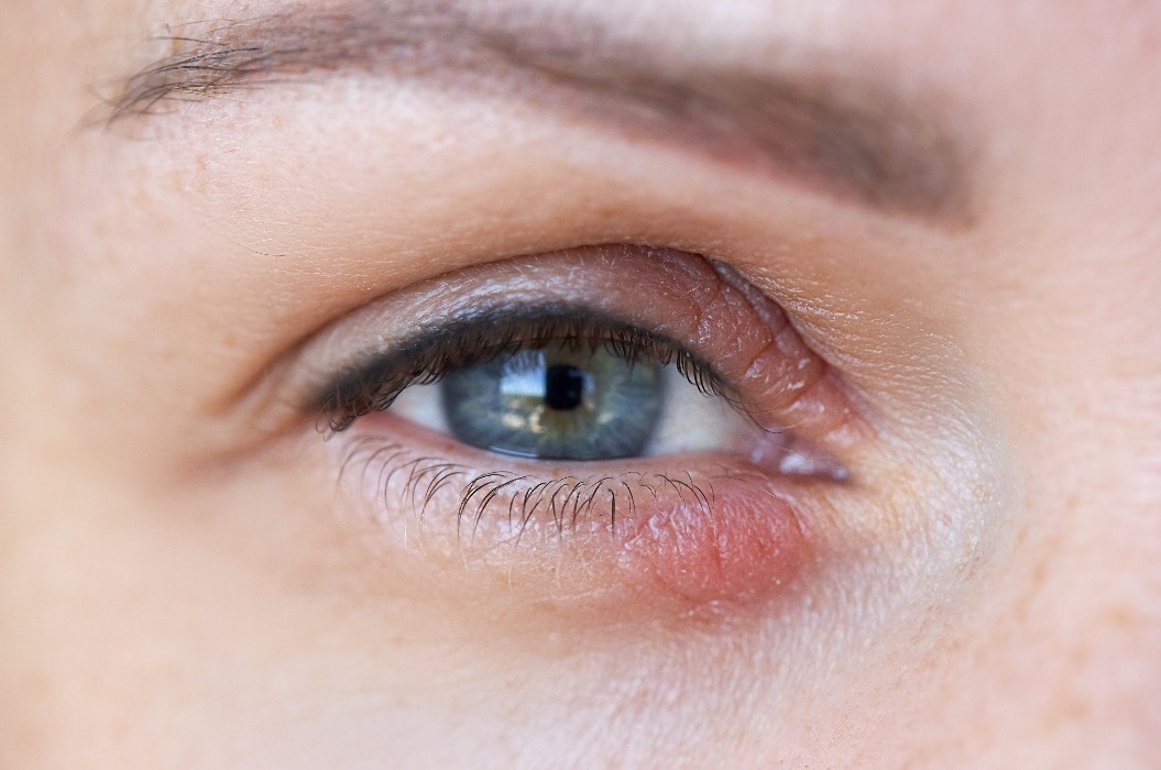 Erkrankungen – Augenzentrum am Klinikum/Heumarkt